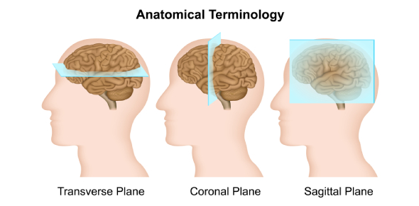 Anatomical Terminology Quiz How Well Do You Know ProProfs Quiz